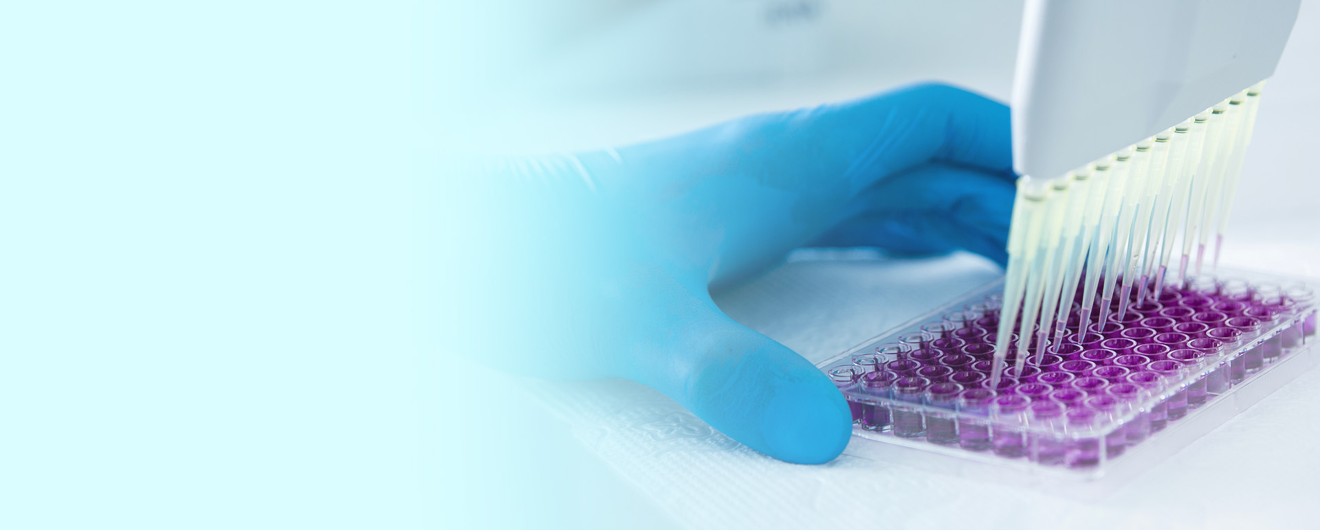 Bioanalysis of Large Molecules | Syngene Assay Validation